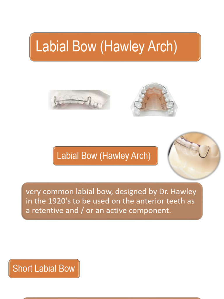 Labial Bow (Hawley Arch) | PDF