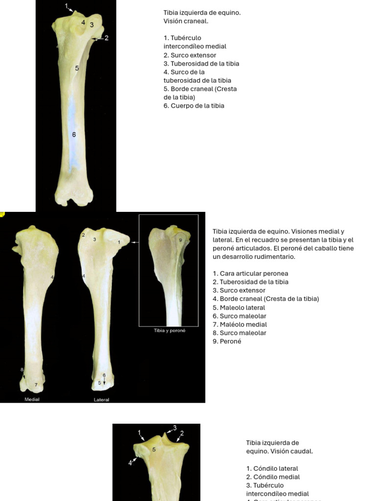 Tibia y Peroné (Fibula) | PDF | Sistema esquelético | Anatomía humana