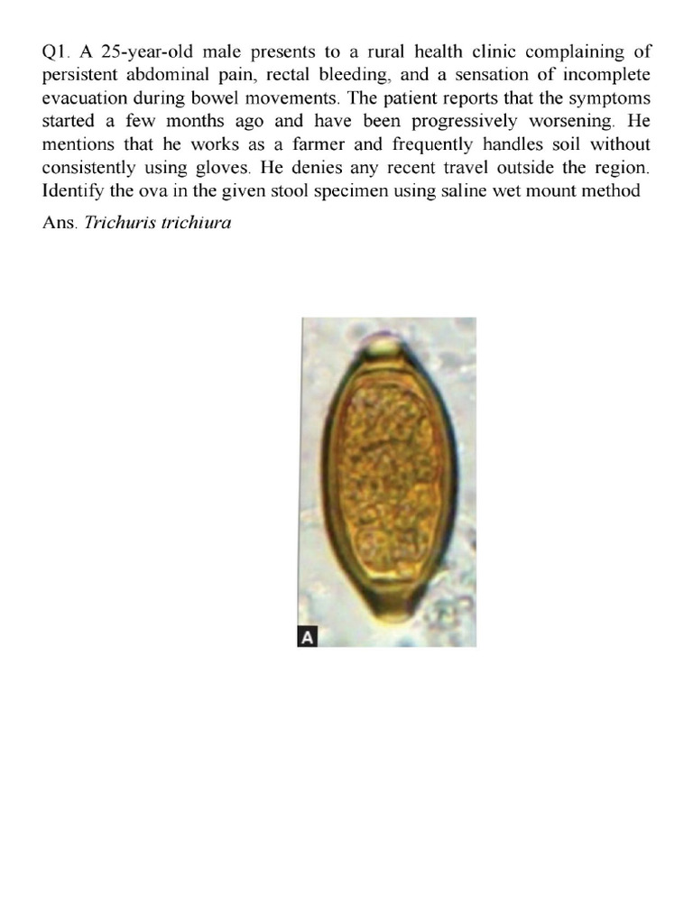 Parasitology Ques & Ans | PDF