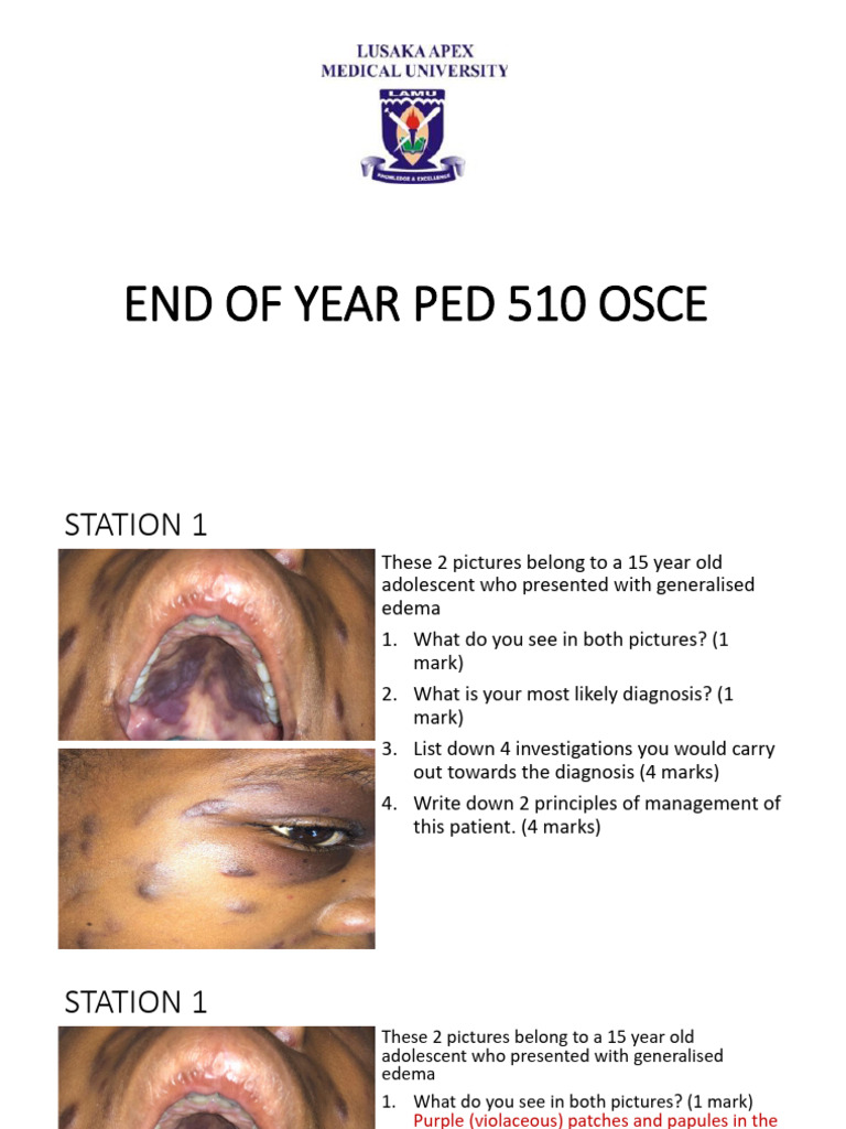 Pediatric Clinical Assessment Stations | PDF | Heart | Malaria
