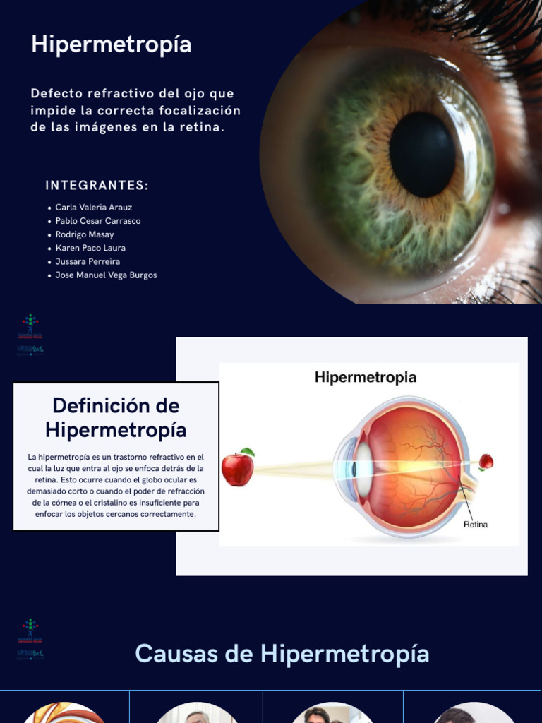 Oftalmologia Hipermetropia - 20250520 - 191220 - 0000-Compressed | PDF ...