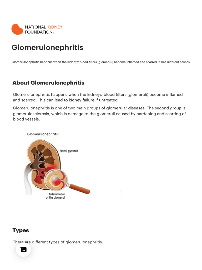 Glomerulonephritis National Kidney Foundation Pdf Kidney Disease