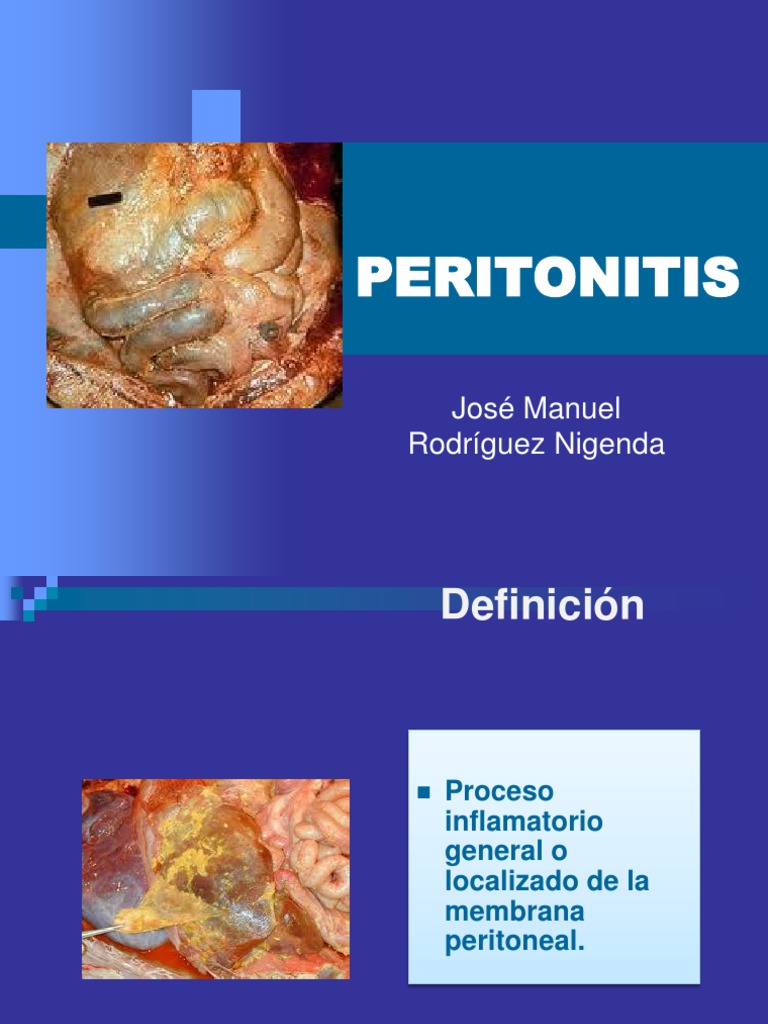 Clasificación y tratamiento de peritonitis | PDF | Inflamación | Citocina