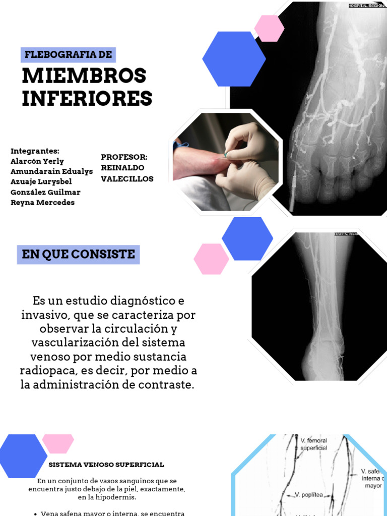 Flebografía: Estudio del Sistema Venoso | PDF | Vena | Angiografía