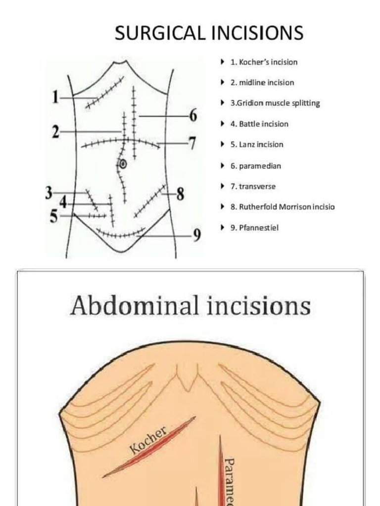 Gross Anatomy Slides (Abdomen) (DR Mohammed) Hod Anatomy | PDF