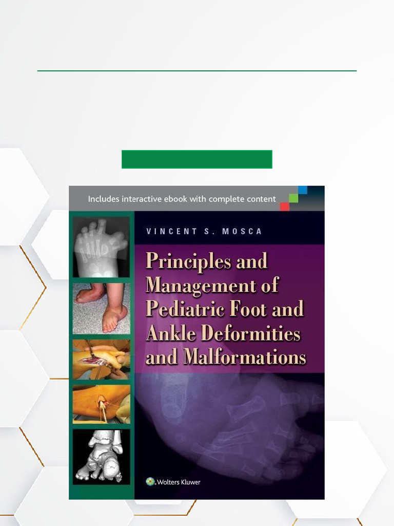 Principles and Management of Pediatric Foot and Ankle Deformities and ...