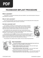 Impella Insertion Training Guide | PDF | Catheter | Heart