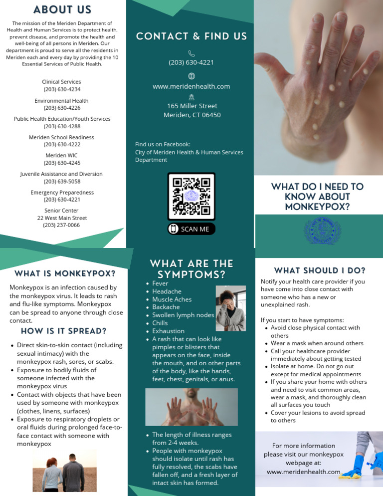 Meriden Monkeypox Brochure | PDF | Medicine | Diseases And Disorders