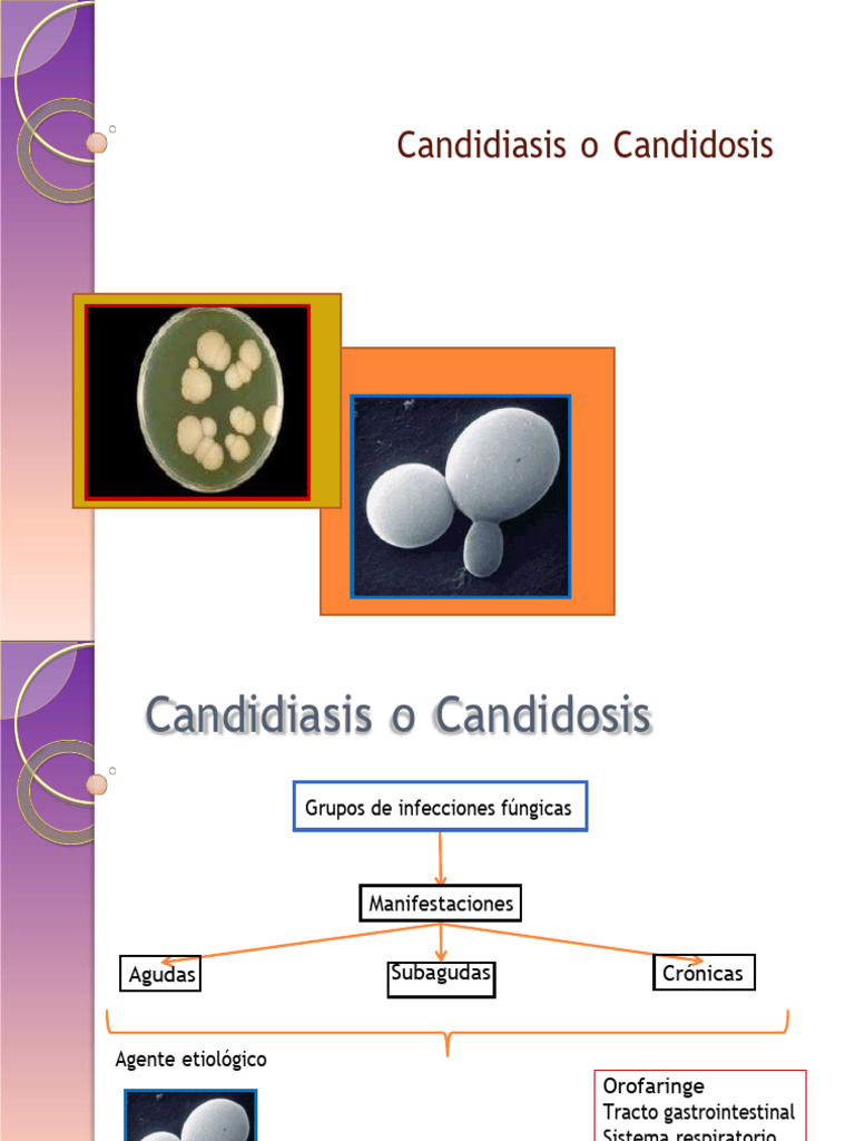 Candidiasis: Tipos, Causas y Diagnóstico | PDF | Candidiasis ...