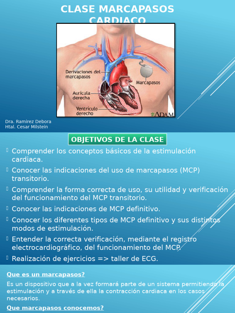 Indicaciones y Tipos de Marcapasos | PDF | Marcapasos cardíacos ...