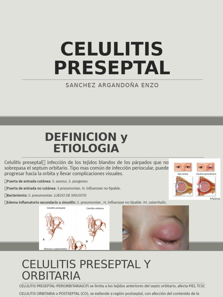 Celulitis Preseptal Enzo | PDF | Ct Scan | Inmunología