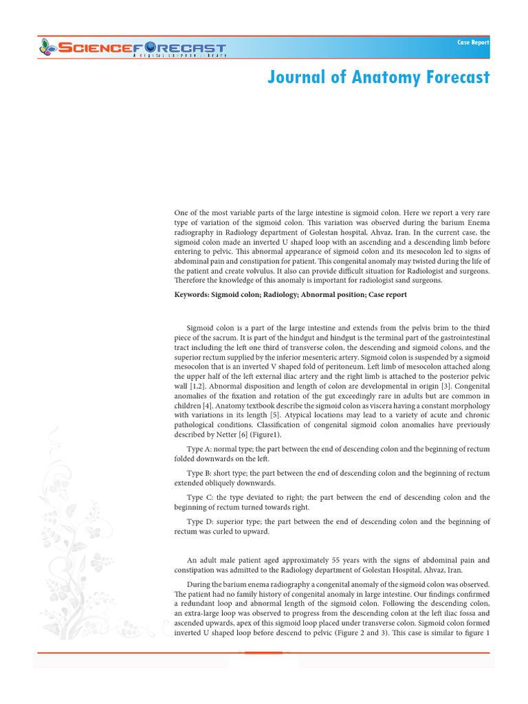 Sigmoid and Colon Netter | PDF | Large Intestine | Abdomen