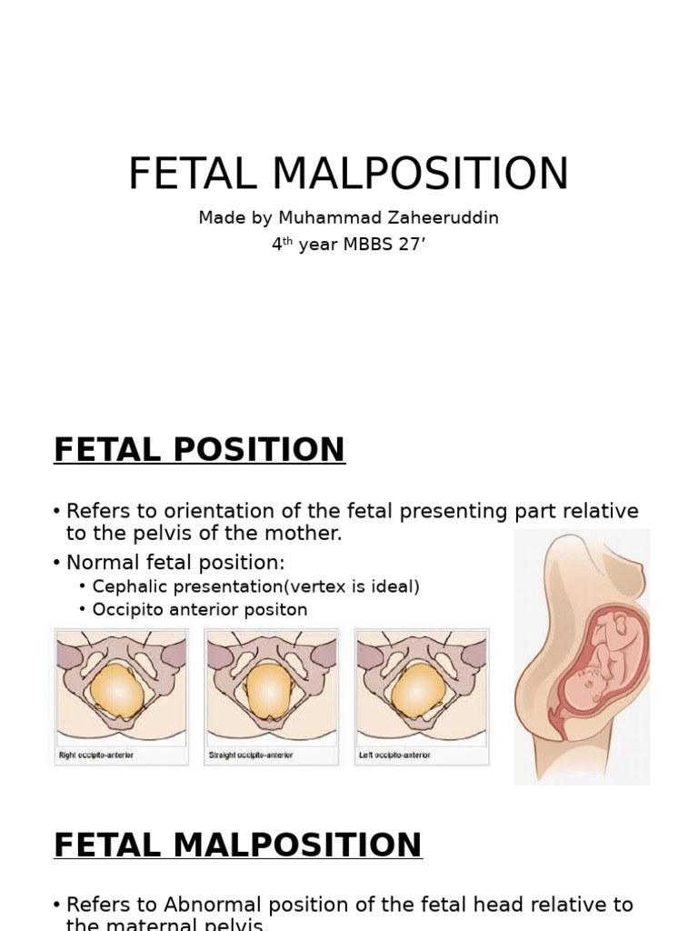 Fetal Malposition | PDF