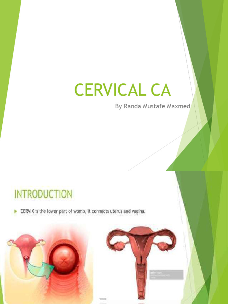 Cervical CA 2 | PDF