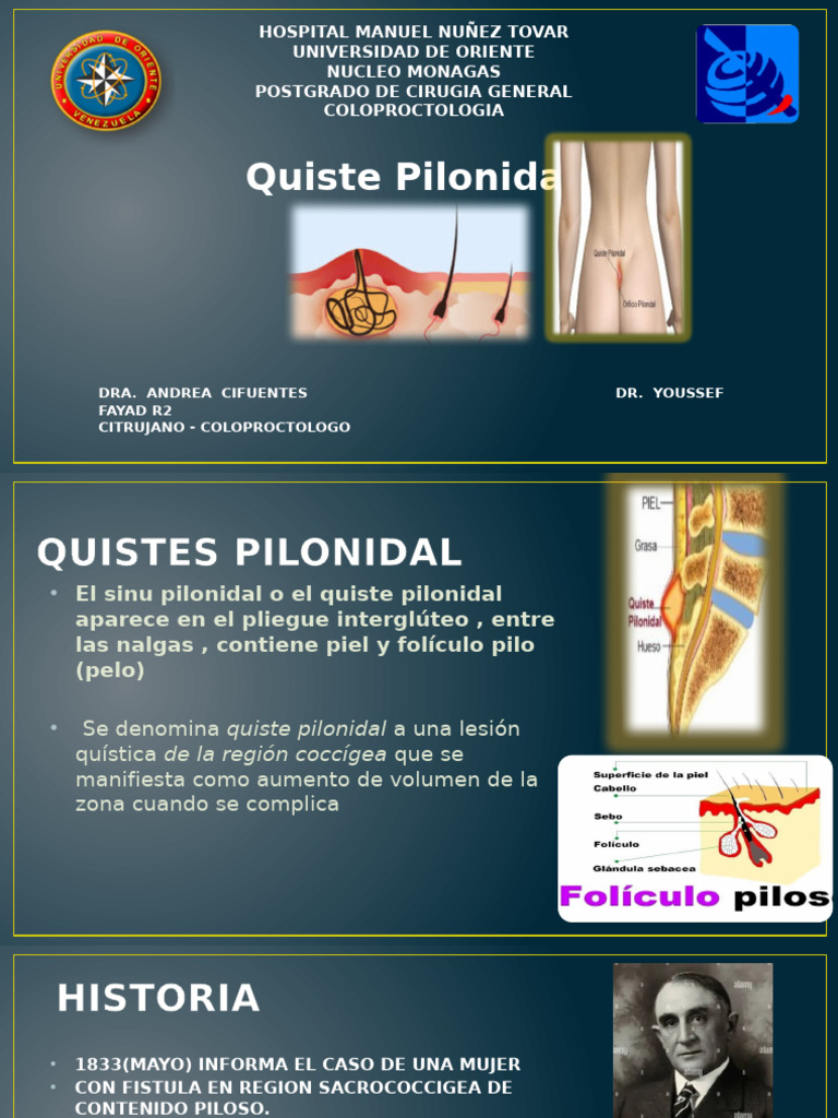 Quiste Pilonidal Youssef | PDF | Enfermedades y trastornos ...