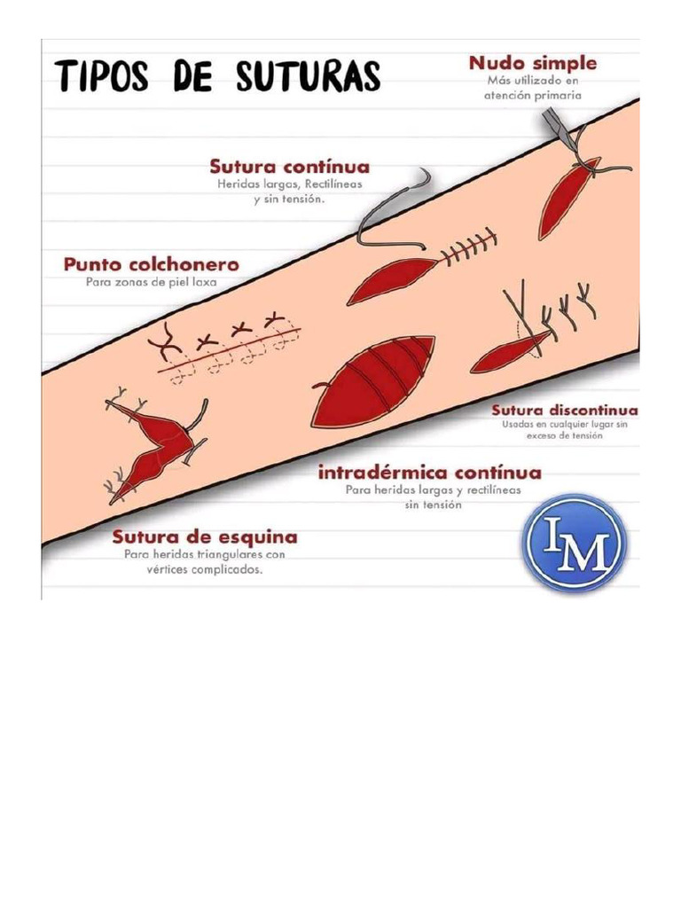 Tipos de Suturas | PDF