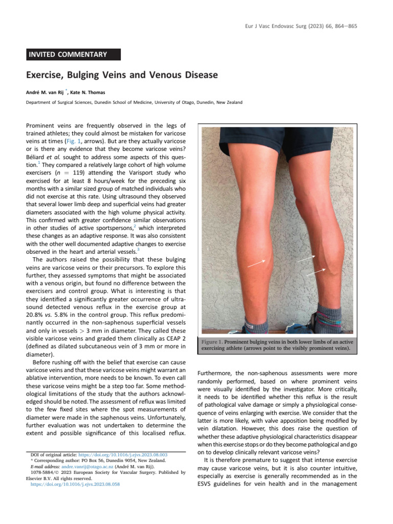 Exercise, Bulging Veins | PDF | Vein | Varicose Veins