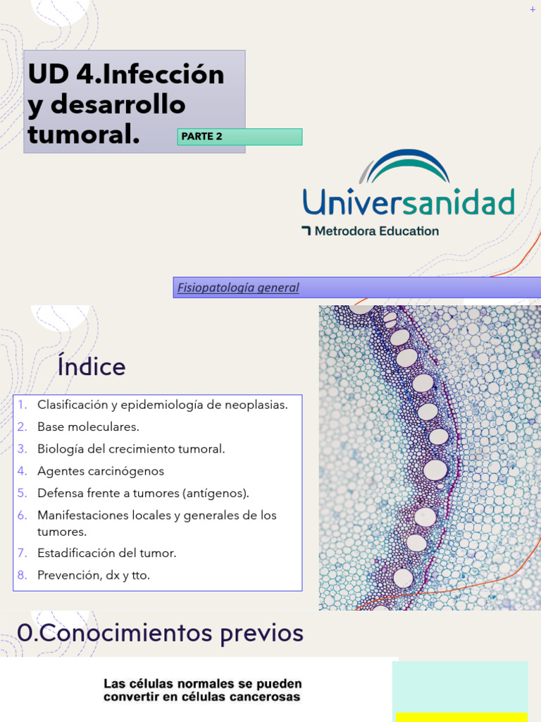 UD4.2.Desarrollo Tumoral. | PDF | Cáncer | Sistema inmune
