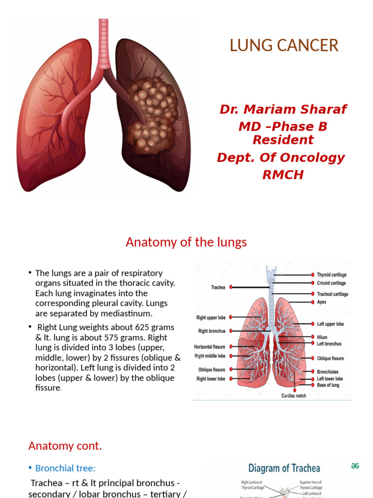 Lung Cancer Presentation by Mariam Sharaf 3 | PDF | Lung | Lung Cancer