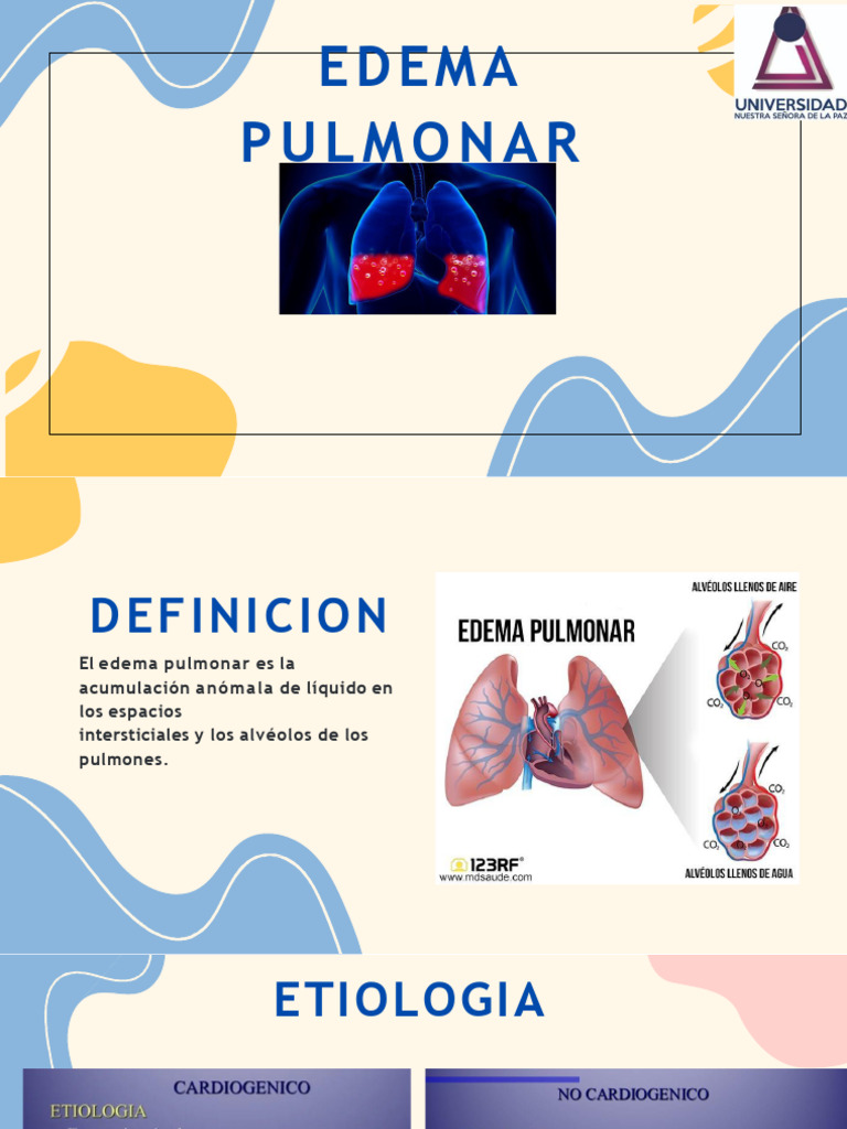 Edema Pulmonar: Causas y Tratamiento | PDF | Edema | Pulmón