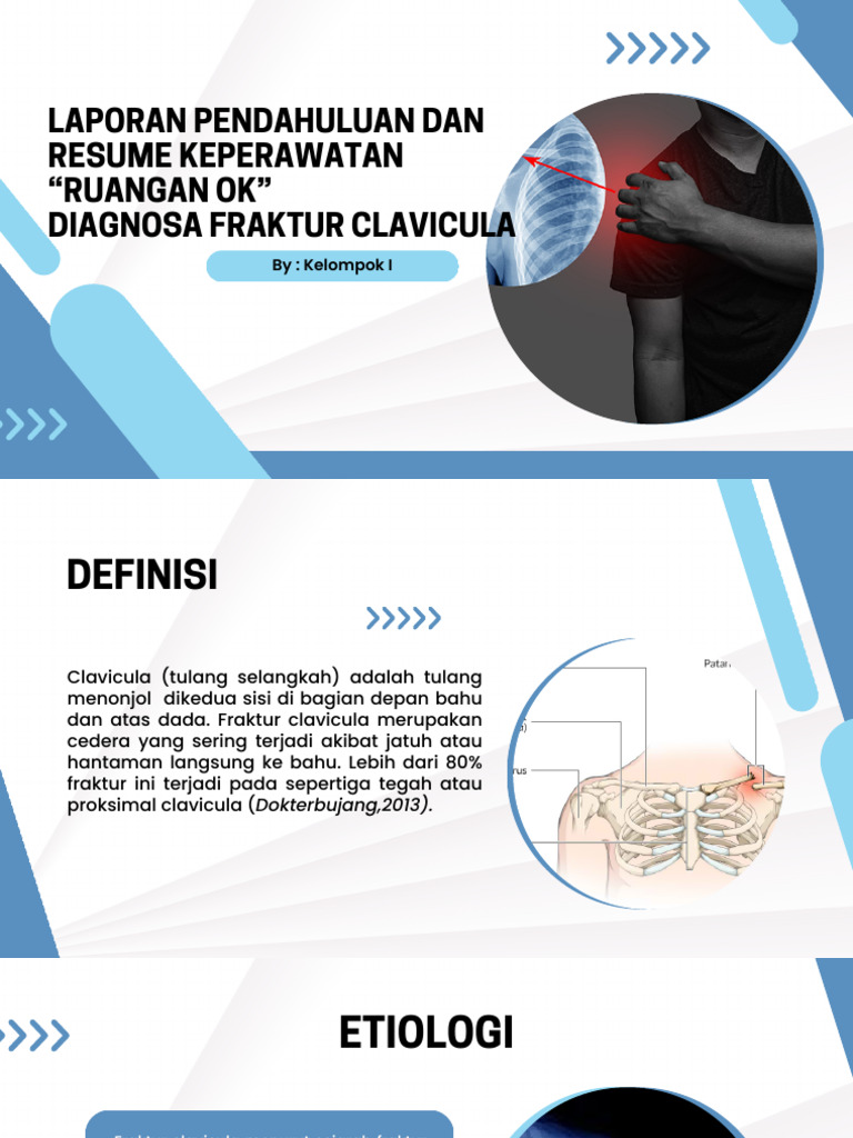 Penatalaksanaan Fraktur Clavicula di Ruang OK | PDF