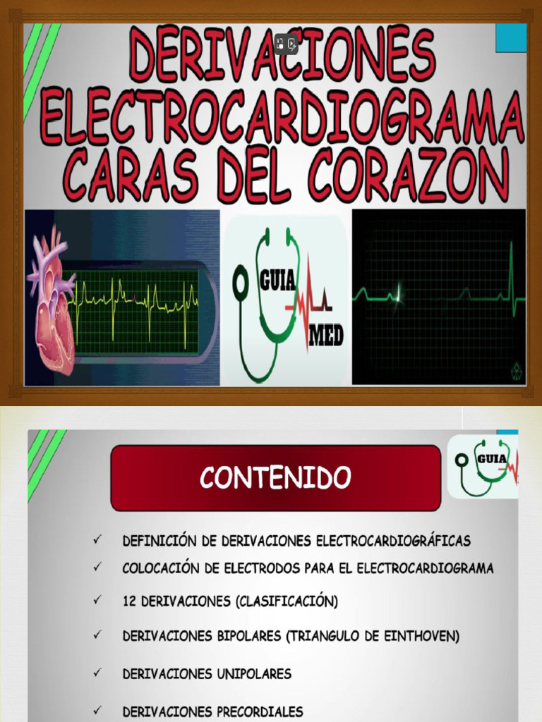 Derivaciones ECG Caras Corazon | PDF