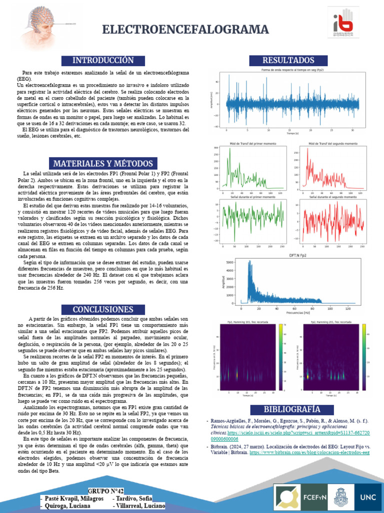Análisis de EEG con sistema 10-10 | PDF | Electroencefalografía | Cerebro