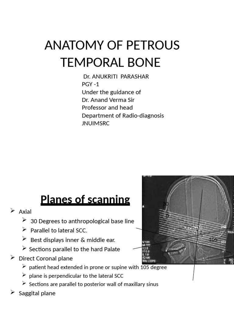 Anatomy of Petrous Temporal Bone-1 | PDF | Ear | Auditory System