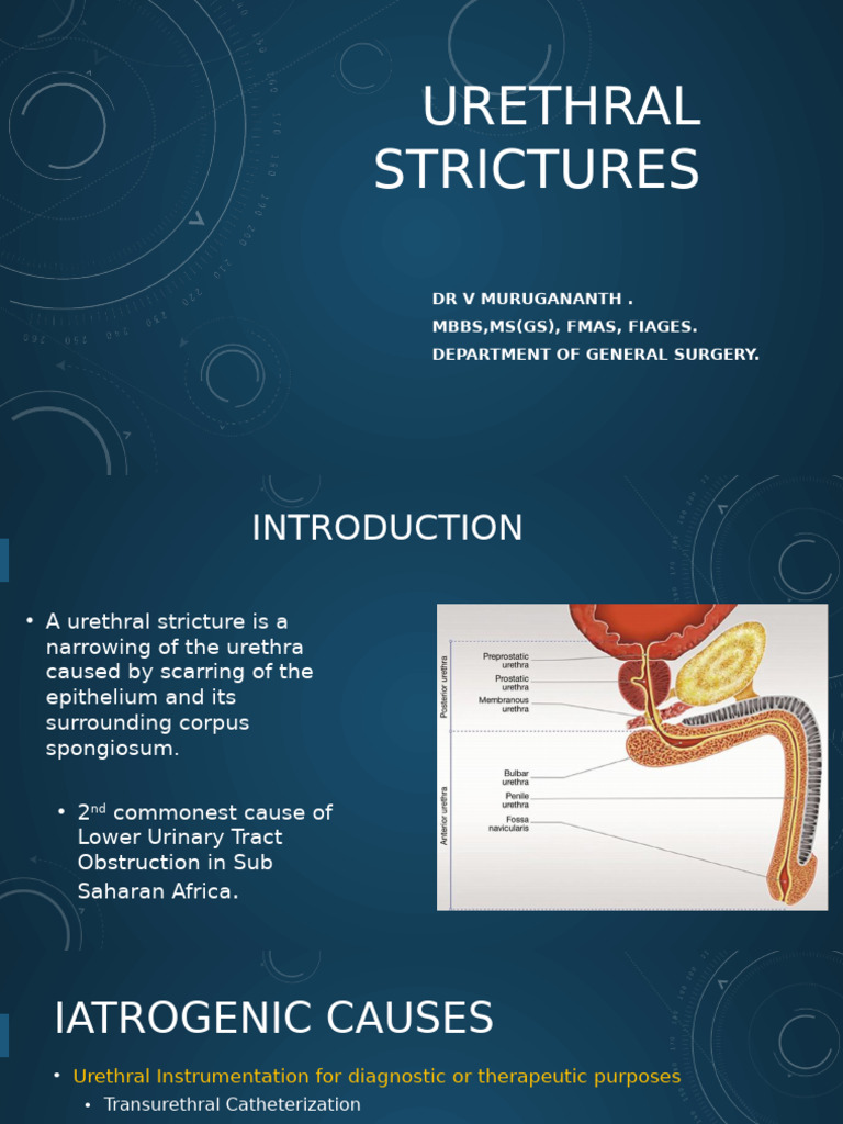 Urethral Stricture GS DR VMR | PDF | Genitourinary System | Medical ...