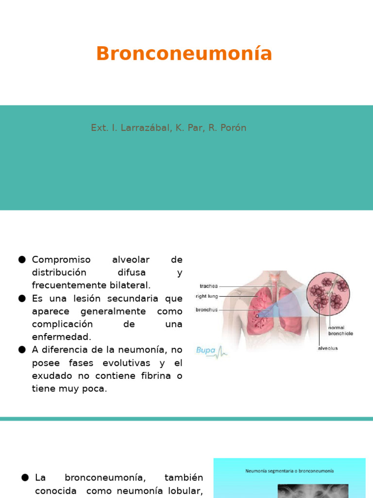 Bronconeumonía | PDF | Neumonía | Inmunología