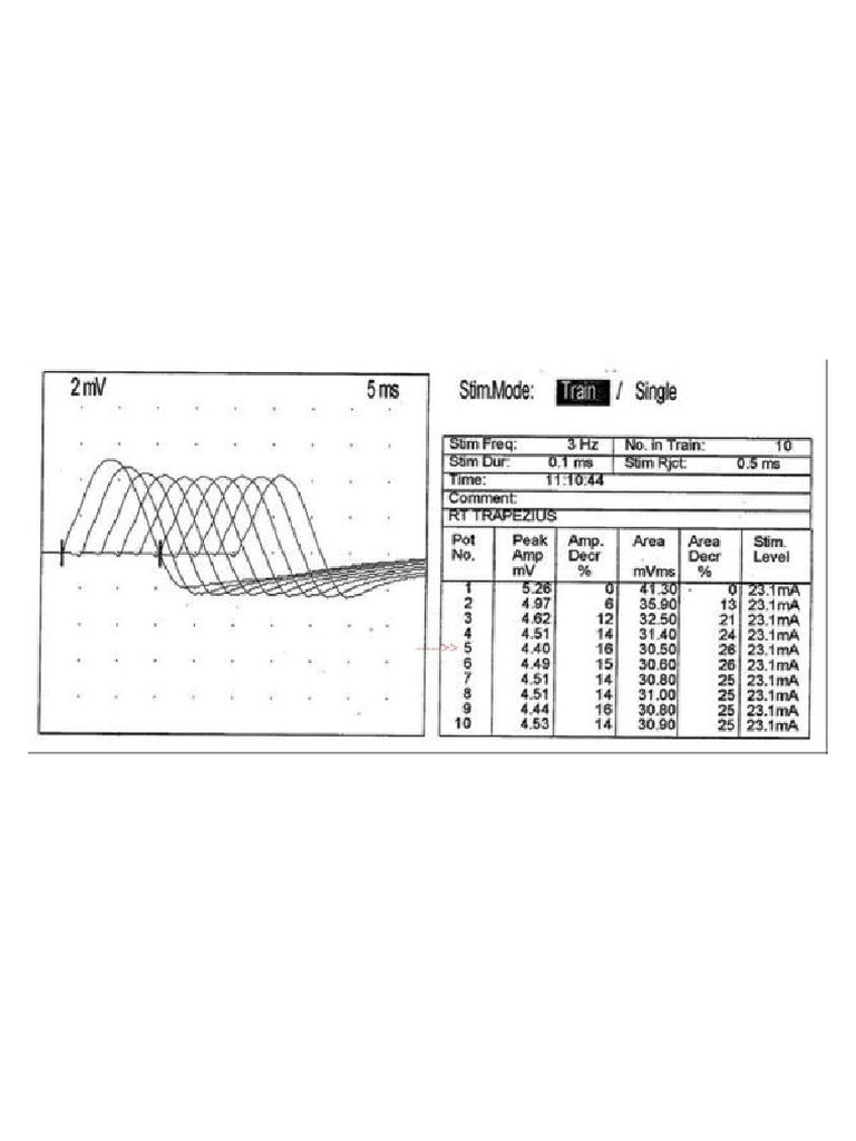 Neurophysiology by Eman | PDF