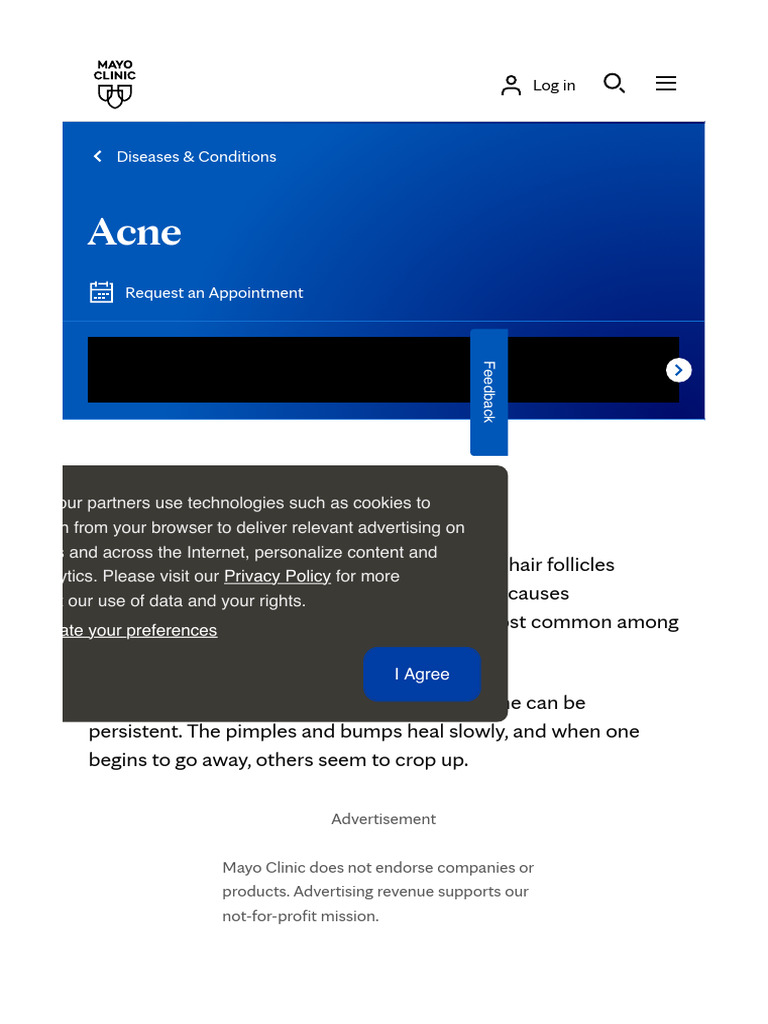 Acne - Symptoms and Causes - Mayo Clinic | PDF | Medical Specialties | Skin