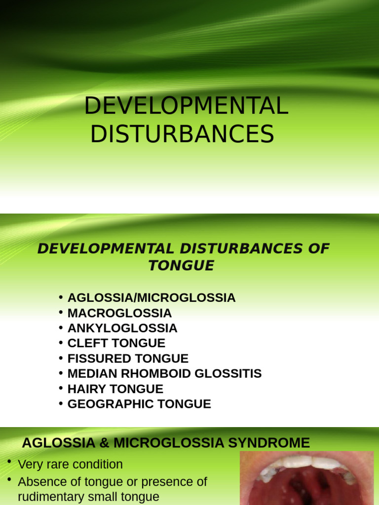 Developmental Disturbances - PPTX Pedo | PDF | Dental Anatomy | Human Tooth
