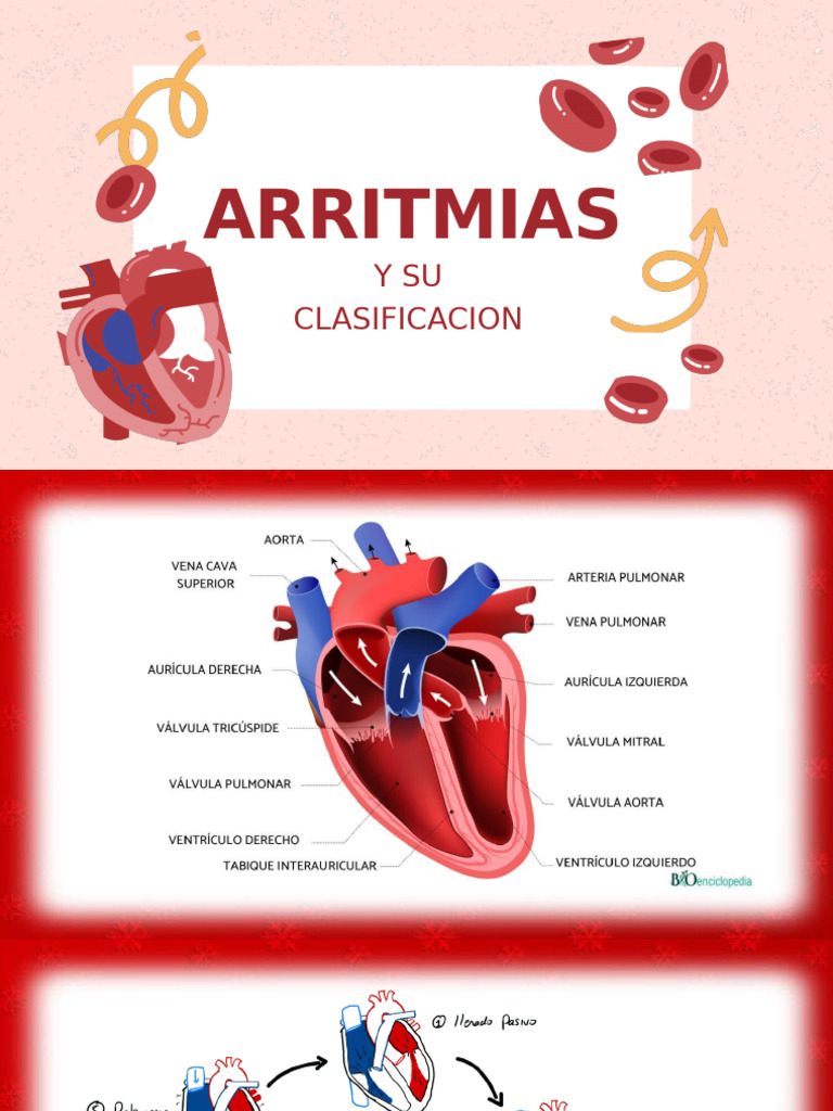 Arritimias y Clasificacion de Las Arritmias | PDF | Corazón | Medicina ...