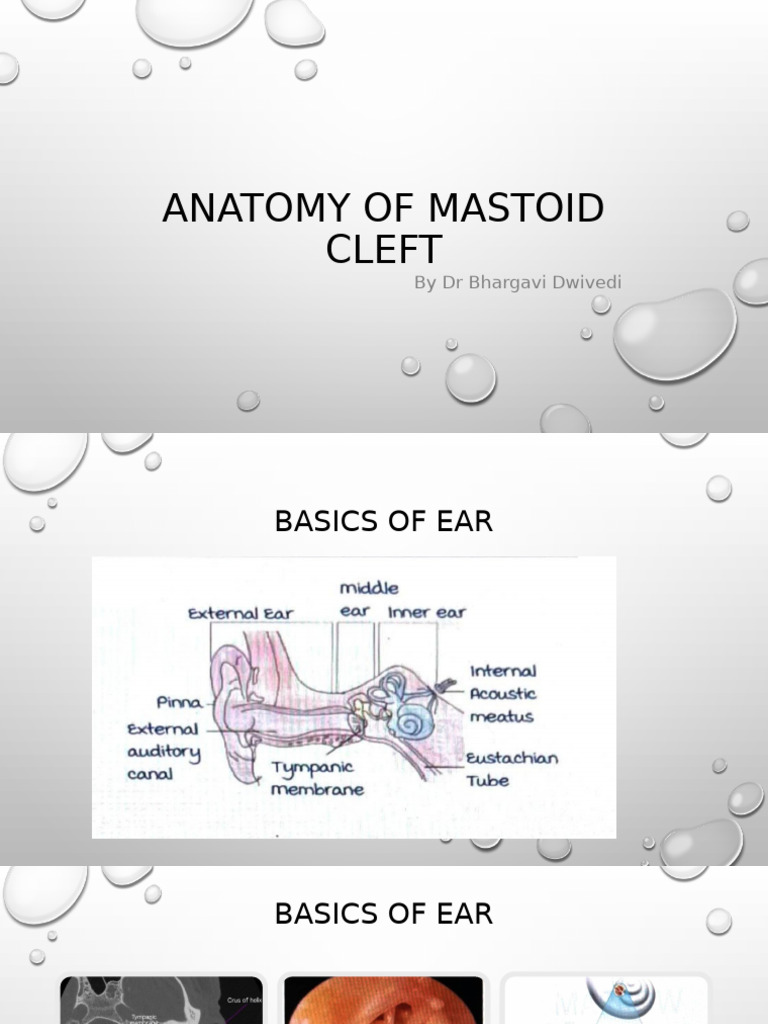 Mastoid Cleft Bhargavi 1 | PDF | Ear | Sensory Organs