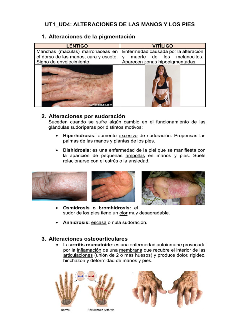Ut1 - Ud4 - Alteraciones de Las Manos y Los Pies | PDF | Pie | Transpiración
