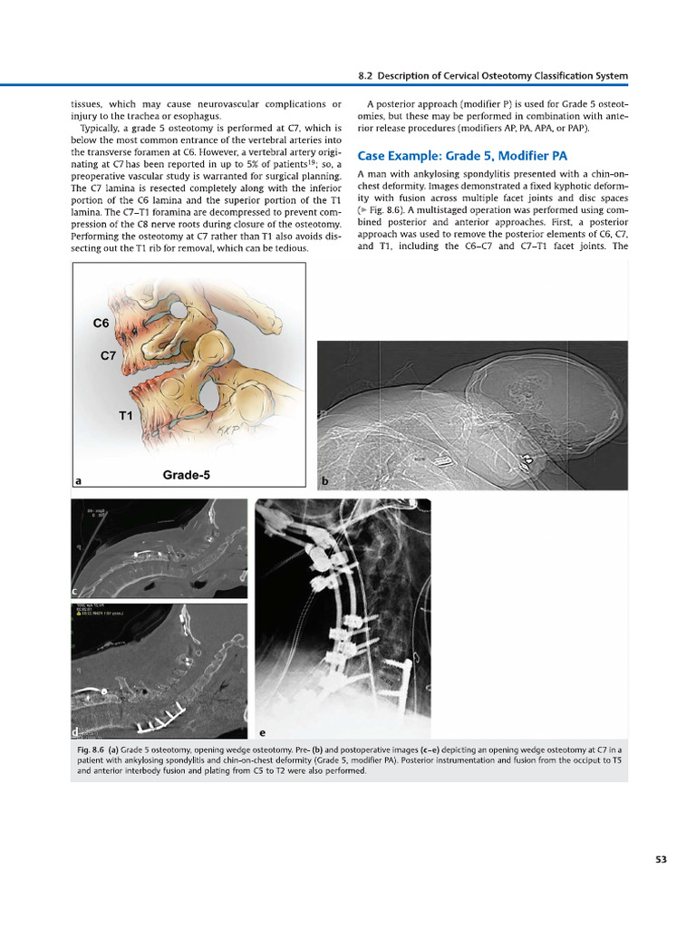 Osteo de Soustraction | PDF