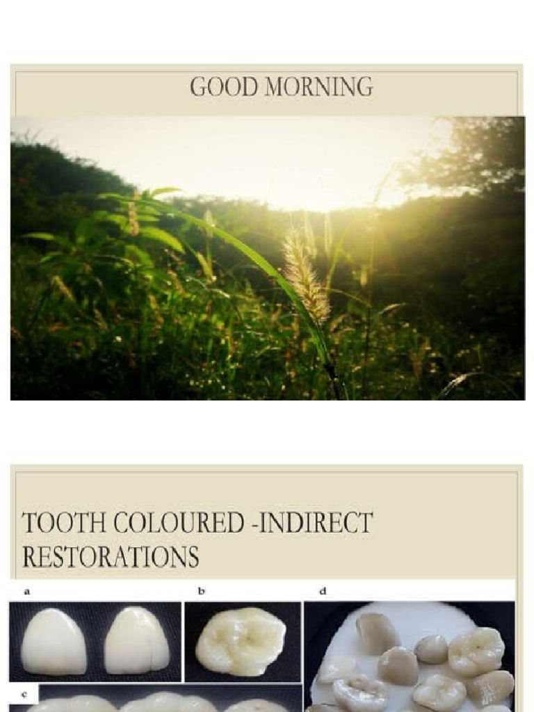 Indirect Restoration | PDF