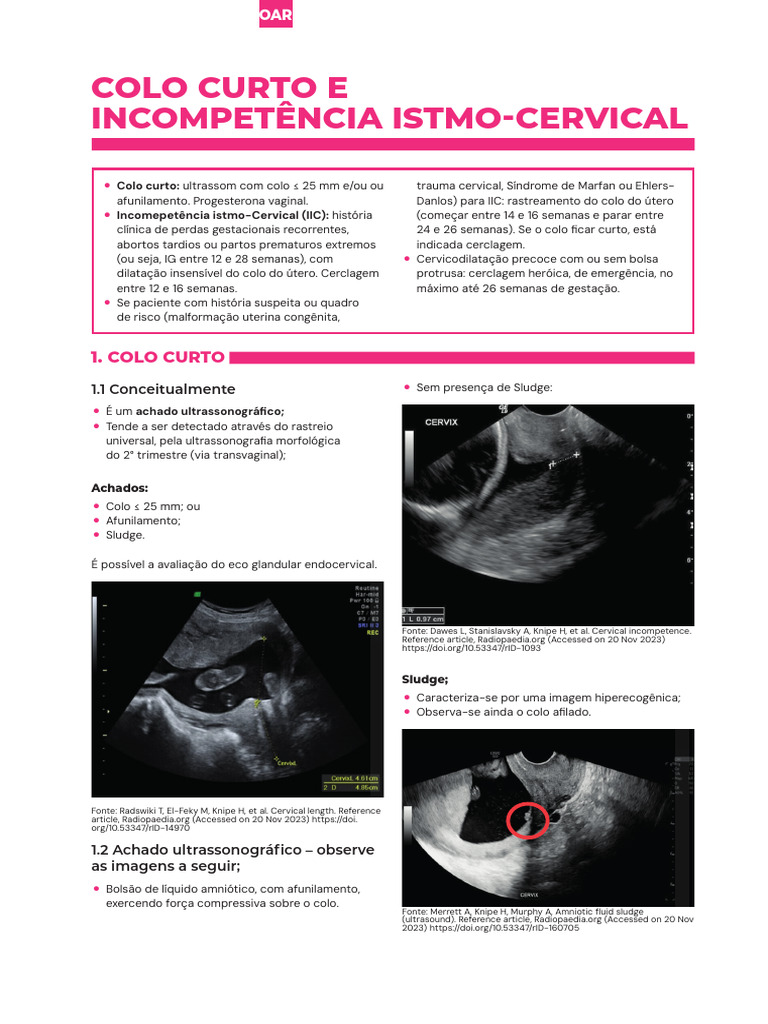 Colo Curto e Incompetência Cervical | PDF | Reprodução humana ...