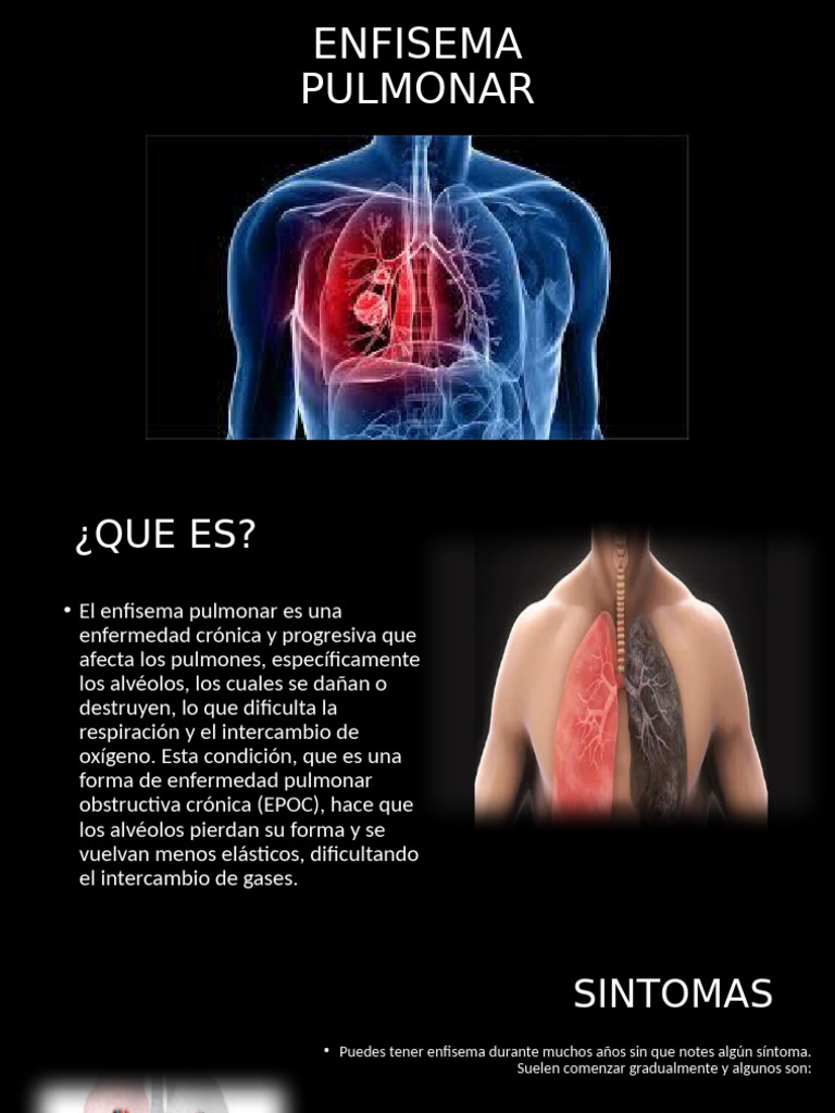 Enfisema Pulmonar | PDF | Enfermedad pulmonar obstructiva crónica | Pulmón