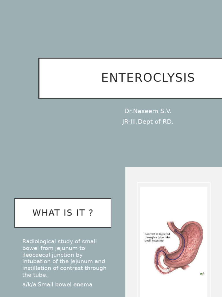 Enteroclysis 170929160642 | PDF | Gastrointestinal Tract | Gastroenterology