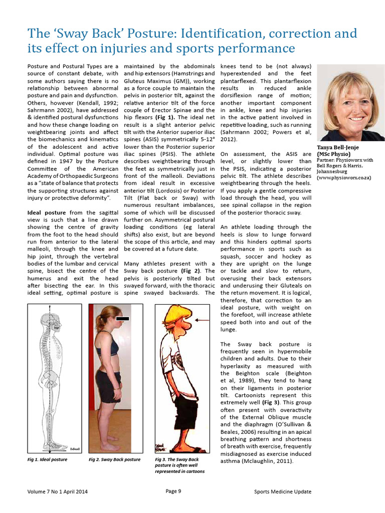 The Sway Back Posture Identification Correction and Effects Tanya Bell ...