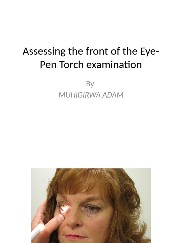Assessing The Front of The Eye - Pen Torch | PDF | Diseases And ...