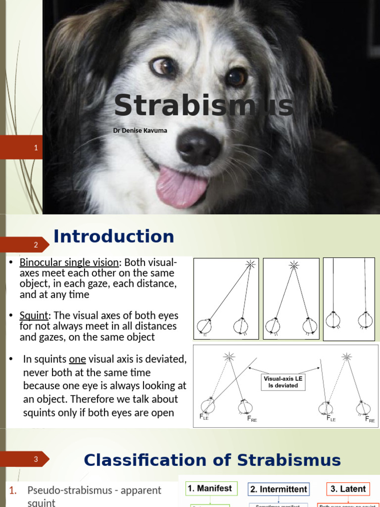 11-Strabismus and Refractive Error | PDF | Myopia | Light