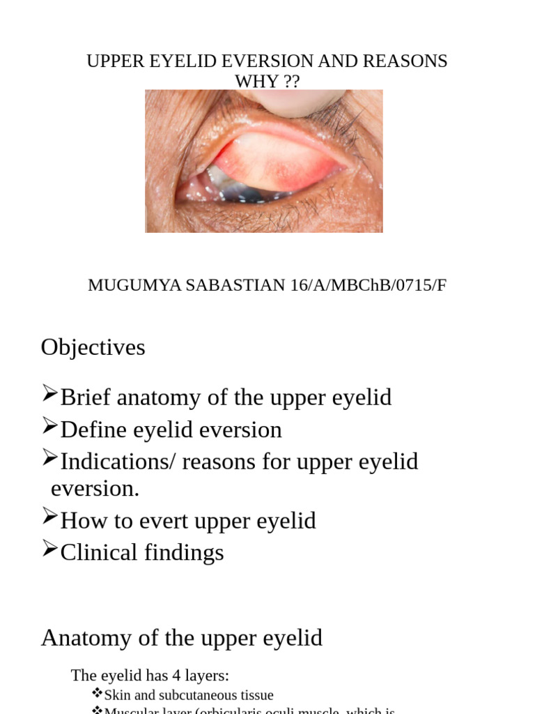 Upper Eyelid Eversion and Reasons Why | PDF | Medical Specialties ...