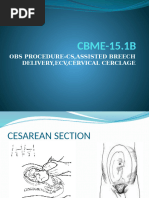 Zavanelli Procedure | PDF | Childbirth | Caesarean Section