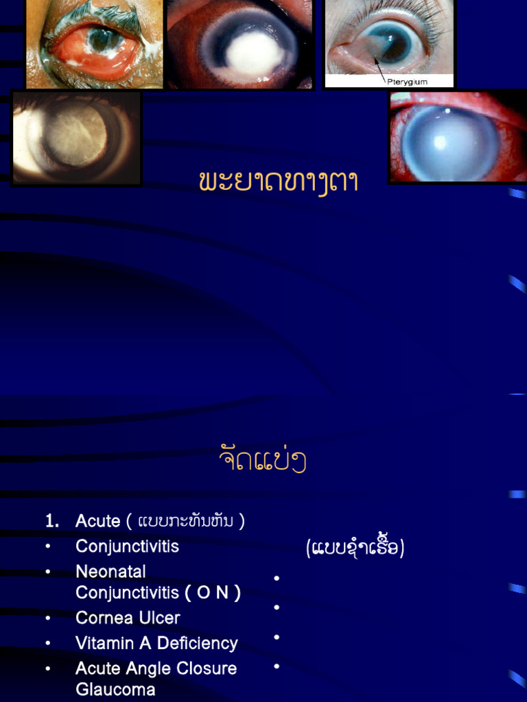 Teache Nurse 2010, Common Eye Disease | PDF | Ophthalmology | Human Eye