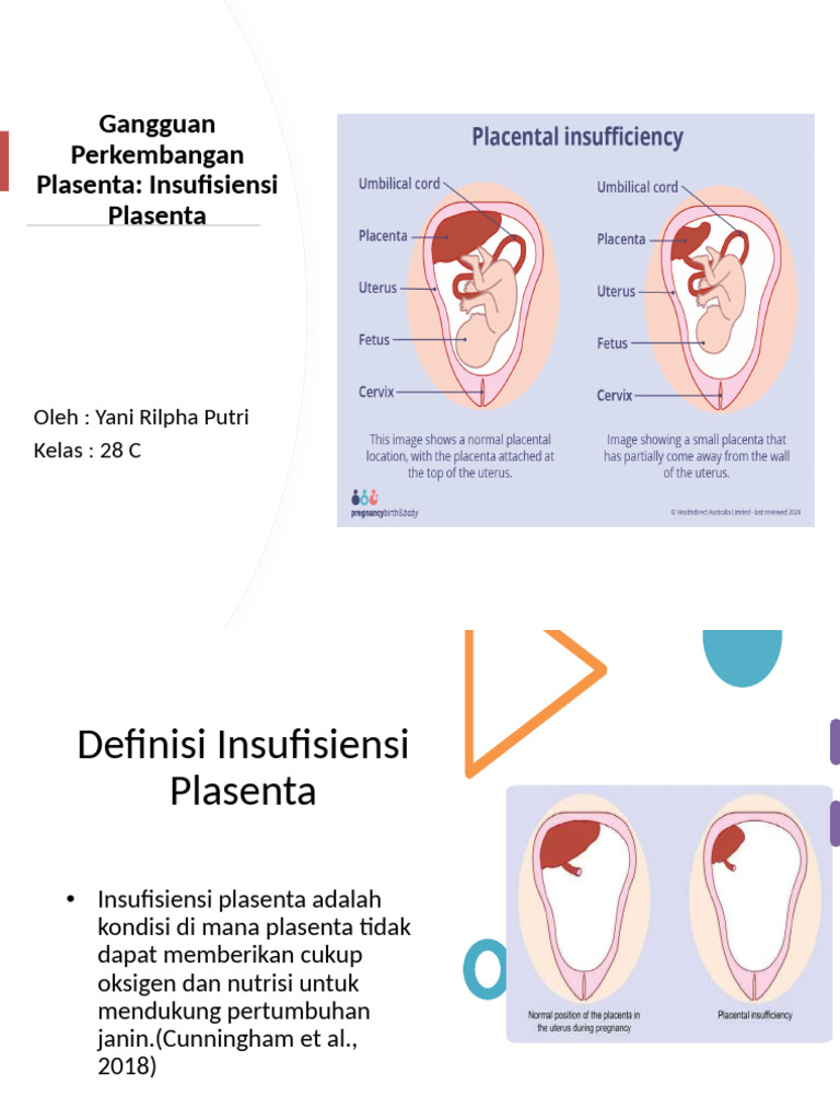 Tugas Fetomaternal Yani Insufisiensi_plasenta | PDF