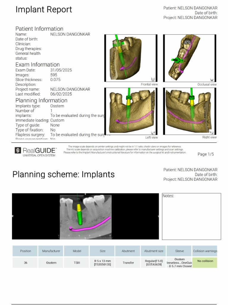 Implant | PDF