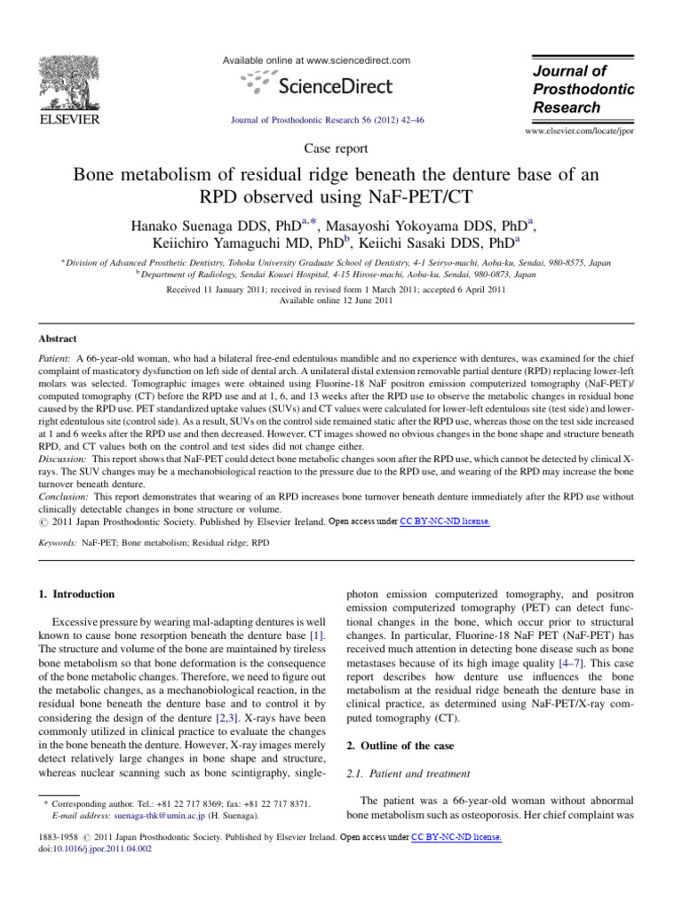 Bone Metabolism of Residual Ridge Beneath The Denture Base of An RPD ...